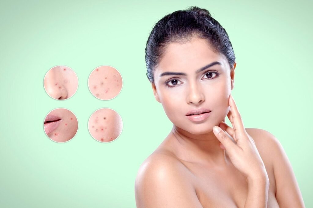 Dr Rashmi Sharma - Best Dermatologist in Delhi